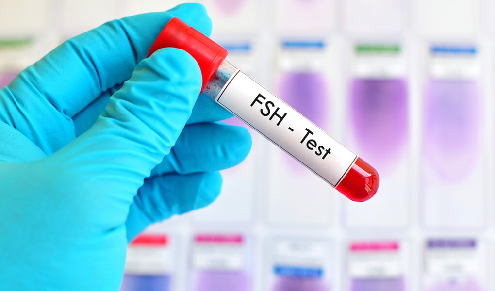 Understanding the Role of FSH (Follicle-Stimulating Hormone) - Cyprus ...